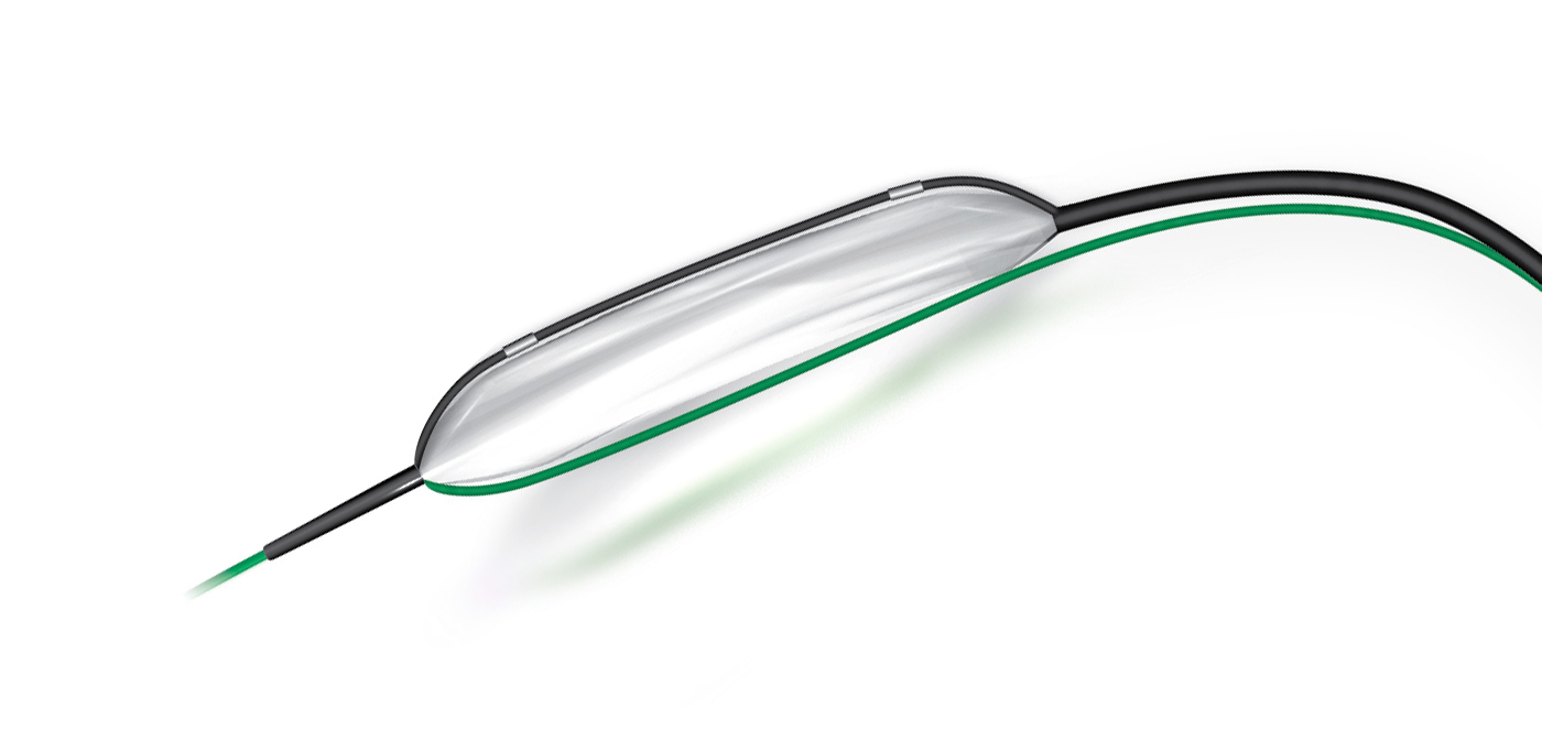 刻痕球囊導管归档 - OrbusNeich